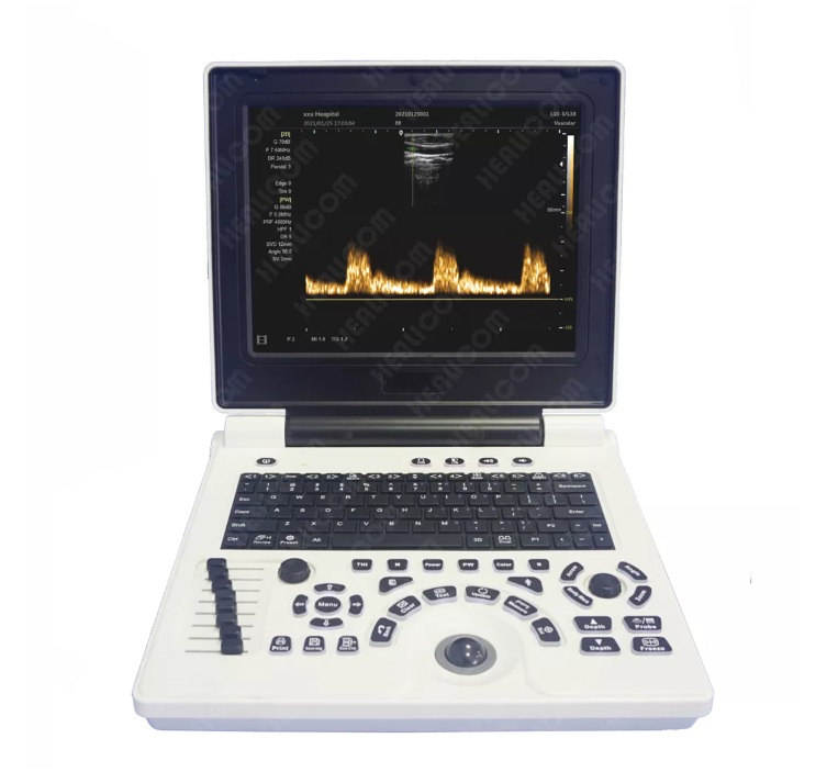 MBW-6P Full Digital Laptop B/W Ultrasound Scanner - MTR medical equipments