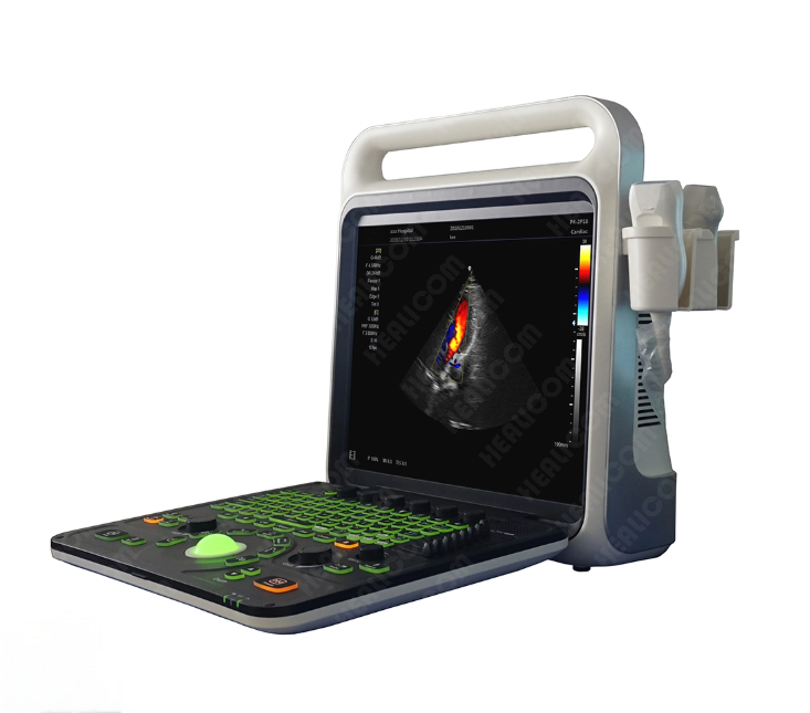MUC-310 Medical Portable Color Doppler Ultrasound Scanner - MTR medical ...